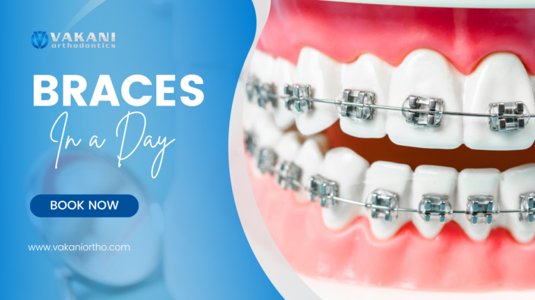 Braces in a Day at Stuart, Fort Pierce, Port St Lucie, Vero Beach, Palm Bay